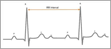 filter detection of weak periodical sound signal having negative snr
