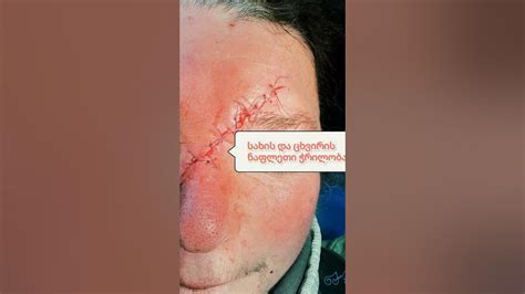 ქირურგი Youtube