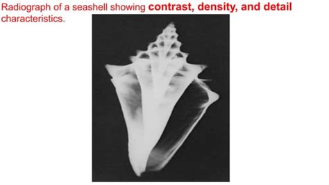Radiographic Quality Density Contrast Detail Radiographic