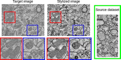 Figure 3 From Deep Learning Based Domain Adaptation For Mitochondria Segmentation On Em Volumes