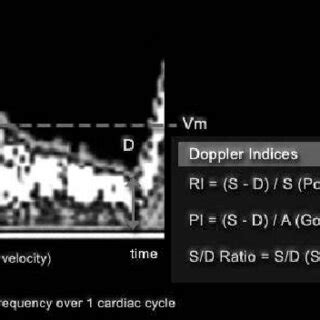 Doppler Waveforms And Flow Velocity Indices Download Scientific Diagram