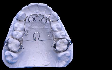 How Does An Alf Dentist Work Dental Implant Procedure Everything