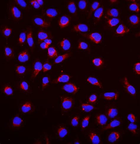 Anti Sgk1 Antibody Picoband Bosterbio A00673
