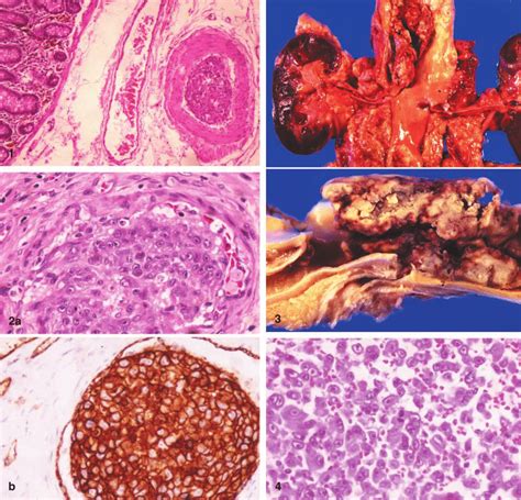 Artery Of The Submucosa Of The Ileocolectomy Specimen Showing Download Scientific Diagram