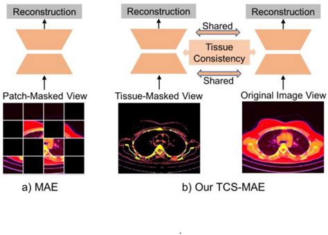 논문 리뷰 Tissue Contrastive Semi Masked Autoencoders For Segmentation Pretraining On Chest Ct