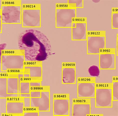 examples of our rbcnet cell detection results showing rbcs and wbcs in