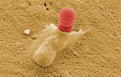 Streptococcus Pyogenes Invasion Into Human Endothelial Cel… Flickr