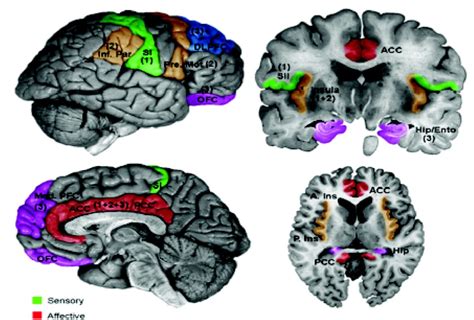 Evoked Potentials Somatosensory Somatosensory Evoked Potentials