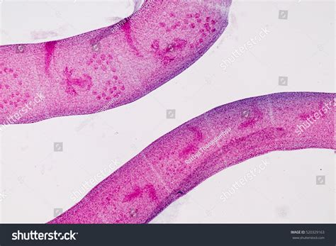 Taenia Solium Parasite Under Microscope Foto De Stock 520329163 Shutterstock