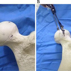 Length Offset Lever Consists Of A Base And A Measuring Ruler Download Scientific Diagram