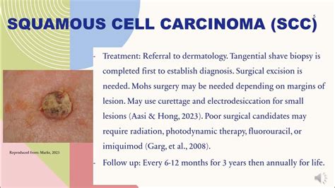 Ak Scc Presentation Nurs 703 Youtube