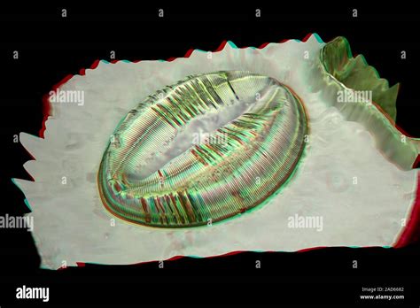 Fossil Diatom Interphako Interference Contrast Light Micrograph Of A Fossilised Diatom Diatoms