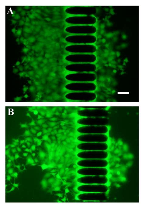 Video Clinical Microfluidic Chip Platform For The Isolation Of Versatile Circulating Tumor Cells