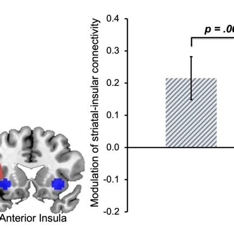Divergent Modulation Of Ventral Striatal Left Anterior Insular Download Scientific Diagram