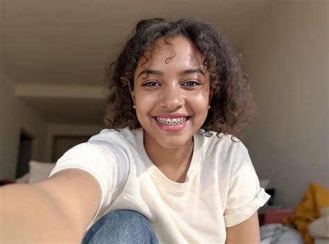 Free AI Braces Filter Online Try Virtual Braces With Bylo Ai