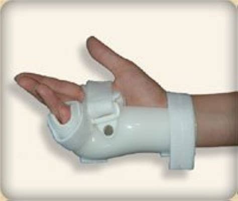 Ulnar Gutter Splint Boxer Fracture Of The Pinky And Ring 57 Off