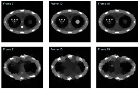 Prior Image Constrained Compressed Sensing Piccs Abstract Europe Pmc