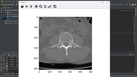 医学影像处理：nifti与dicom格式详解及python操作 Csdn博客