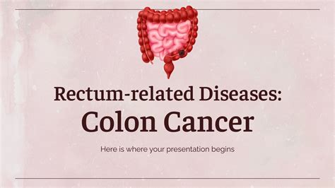 Enfermedades relacionadas con el recto: Cáncer de colon