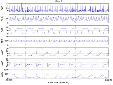 Case Waveform Plots Second Plots Case Waveform Plots Second Plots