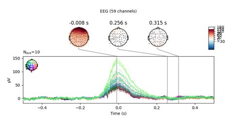 Overview Of Artifact Detection — Mne 1 3 1 Documentation