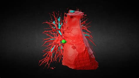 Segmentectomy Planning Vr V1 1 3d Model By Chloroplast [f2a0de4] Sketchfab
