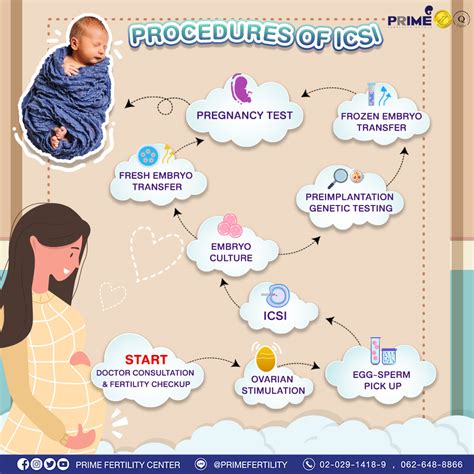 Procedure Of ICSI Prime Fertility Center Dr Poonkiat IVF IUI