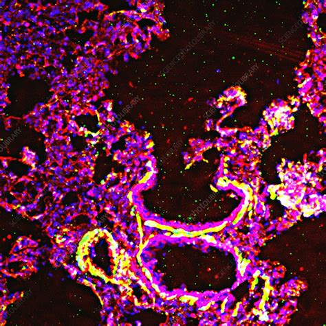 Lung Tissue Fluorescence Micrograph Stock Image C010 5832 Science Photo Library