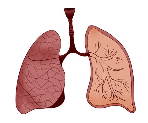 Pulmones Anatomía Parte Del Cuerpo Imagen Gratis En Pixabay Pixabay