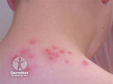 Bites Bites Best Bite All In One Classic Favourites Nova Nova