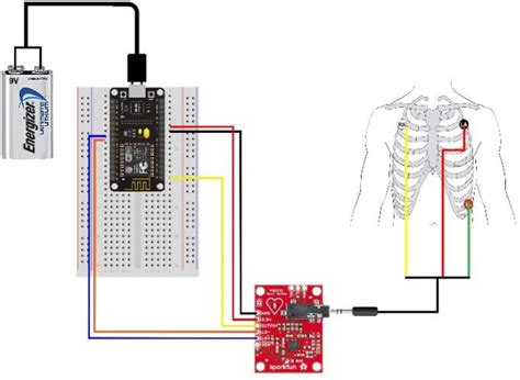 Figure 2 From A Real Time Iot Based Arrhythmia Classifier Using