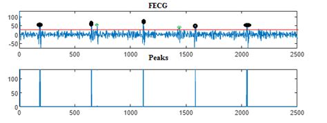 ψ Cl Clifford Multiwavelet Fecg Extraction And Peak Detection For