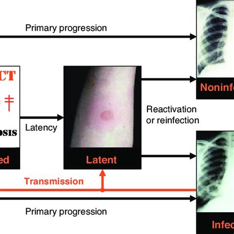 Compartmental Model Of Tuberculosis Transmission Infection Download Scientific Diagram
