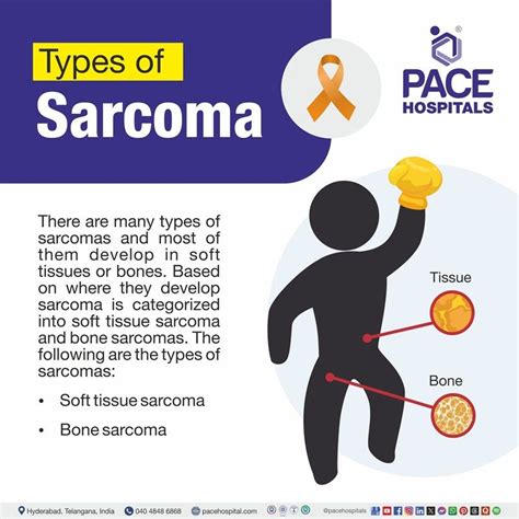 Sarcoma Symptoms Types Causes Treatment And Prevention