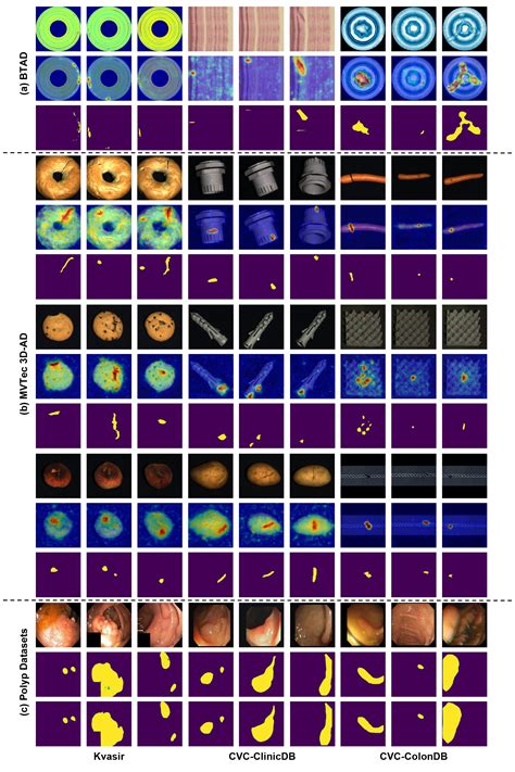 Uninet A Contrastive Learning Guided Unified Framework With Feature Selection For Anomaly Detection