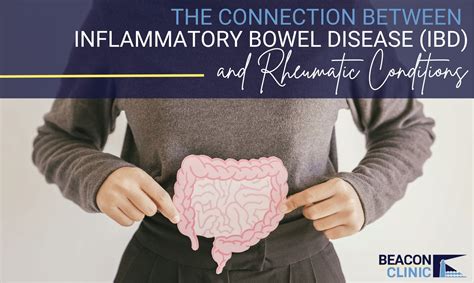 The Connection Between Inflammatory Bowel Disease Ibd And Rheumatic Conditions Beacon Clinic
