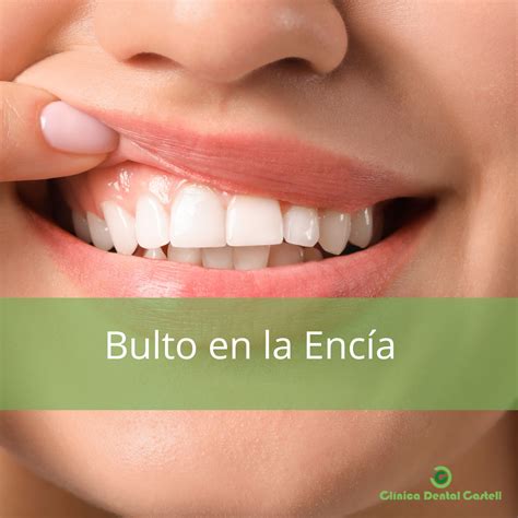 Tengo Un Bulto En La Encía ¿qué Es Y Cómo Se Cura Clínica Castell