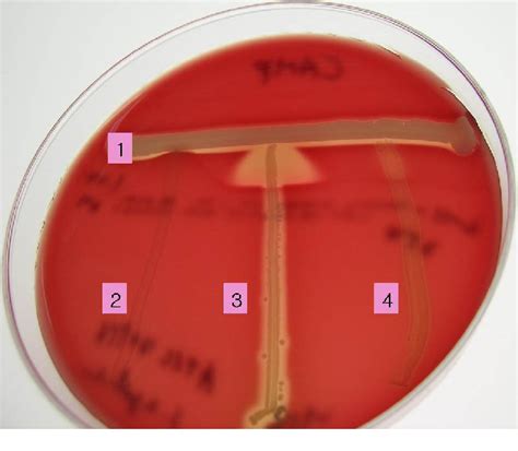 Table 1 From A Case Report Of Arcanobacterium Haemolyticum Isolated From Diabetic Patient With