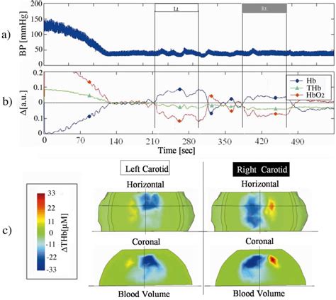 figure 1 from three dimensional optical tomographic brain imaging in