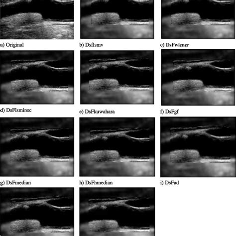 Pdf Despeckle Filtering Software Toolbox For Ultrasound Imaging Of