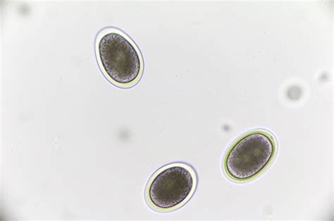 Faecal Analysis Testing Flashcards Quizlet