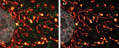 Microscopy Image Processing A Deconvolution Revolution For Confocal Image Enhancement Laser