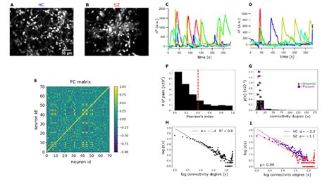 Functional Connectivity Fc And Topology Analysis In Hc And Sz