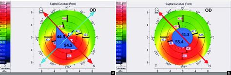 A The Steep And Flat Axes Divided The Topography Into Four Quadrants Download Scientific