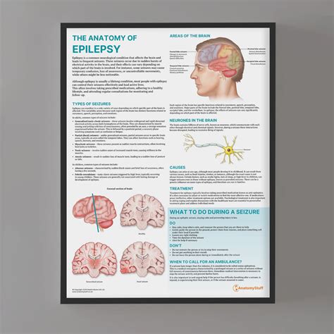 Anatomy Of Epilepsy Chart Seizure Types And Brain Anatomy Poster Anatomystuff