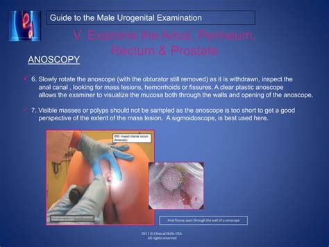 A Guide To The Clinical Male Urogenital Examination Pptx Sexual