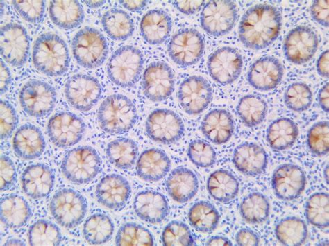 Bap1 Antibody Bsb 109 Bio Sb