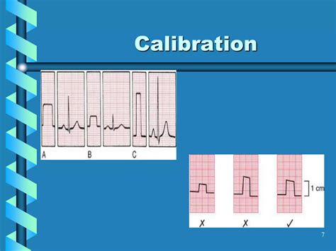 Basic Ecg Interpretation Presentation Ppt