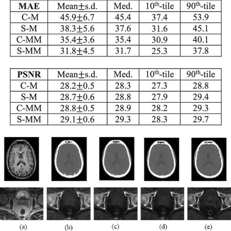 Figure 6 From Estimating Ct Image From Mri Data Using Structured Random