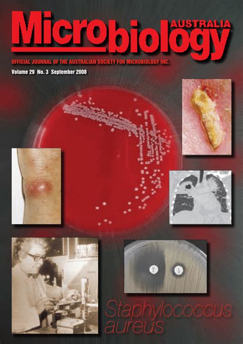 Pdf Two Approaches To Staphylococcus Aureus Typing